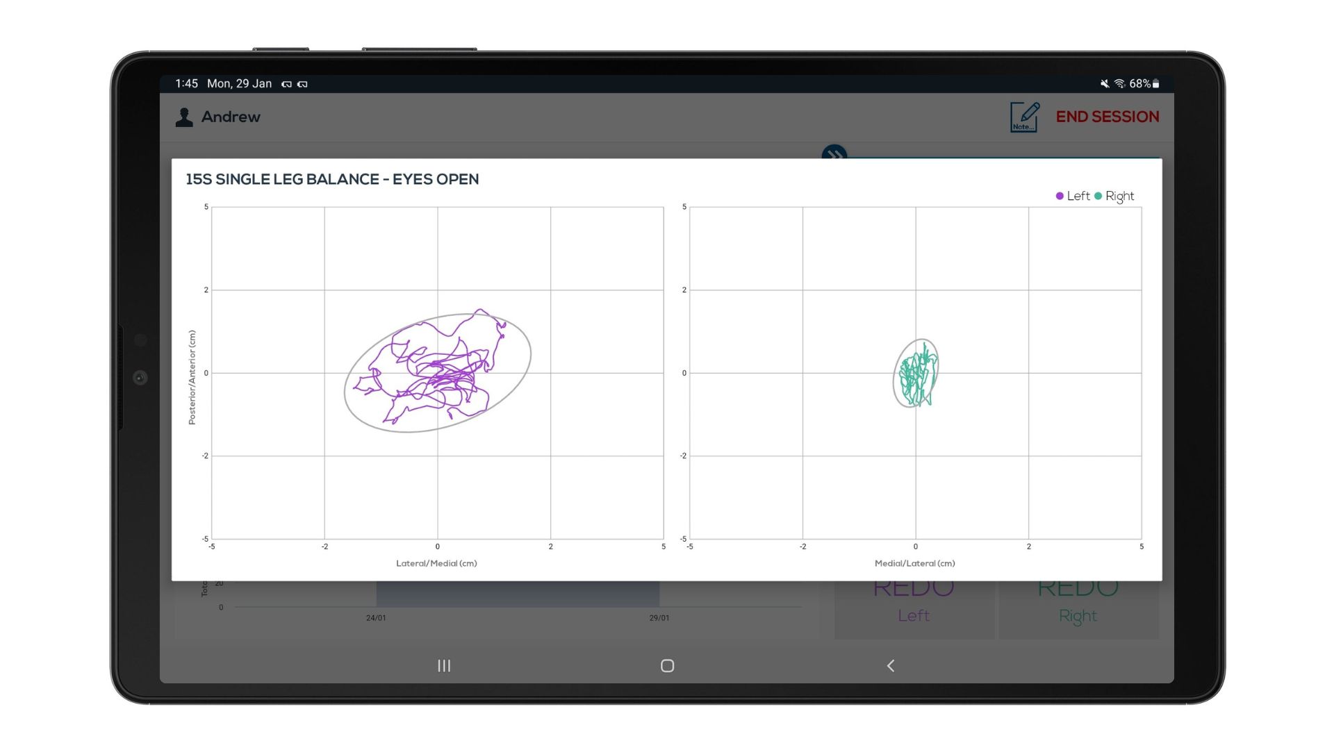 Top Force Plates Metrics For Fall Risk Assessment - Strength By Numbers